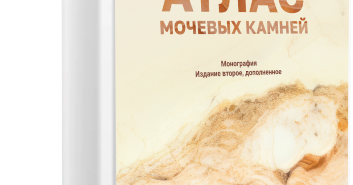 Атлас мочевых камней | UroWeb.ru — Урологический информационный портал!